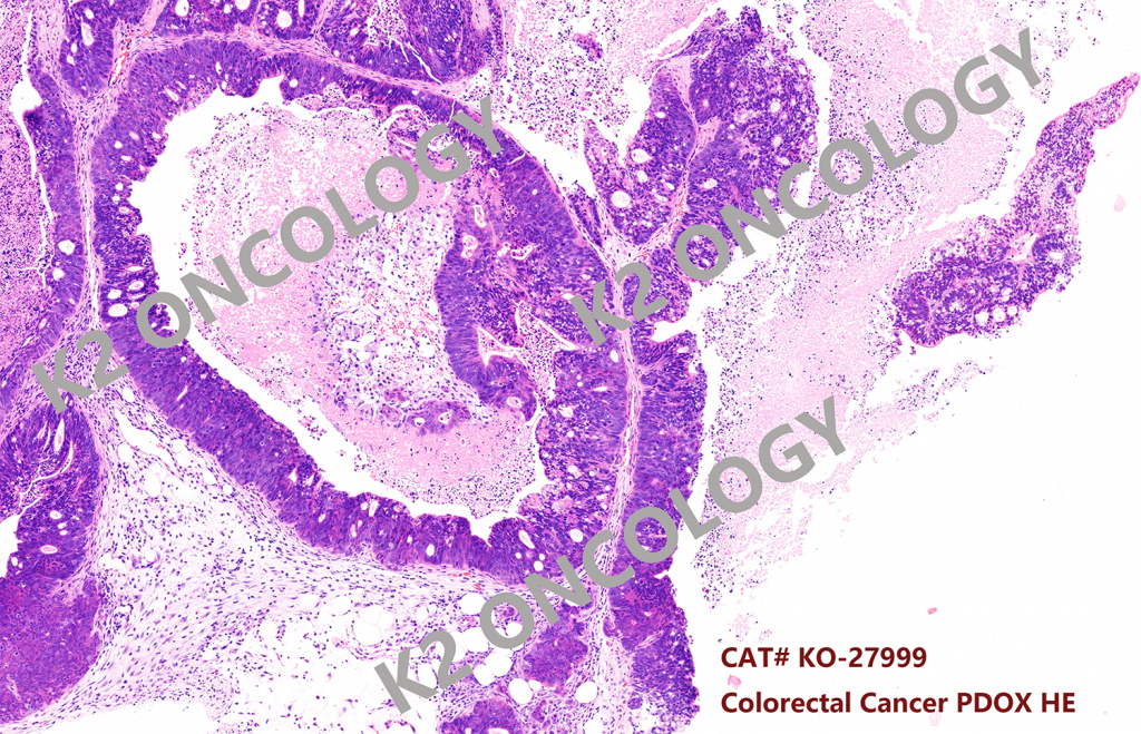 结直肠癌类器官模型 - 北京科途医学科技有限公司 — 类器官技术 | 肿瘤个体化精准医学 | 肿瘤功能性检测