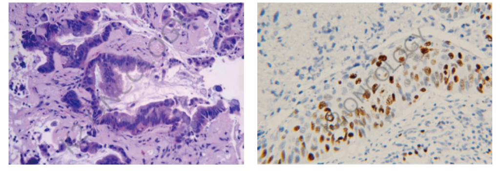 PDOX模型药物评价 - 北京科途医学科技有限公司 — 类器官技术 | 肿瘤个体化精准医学 | 肿瘤功能性检测