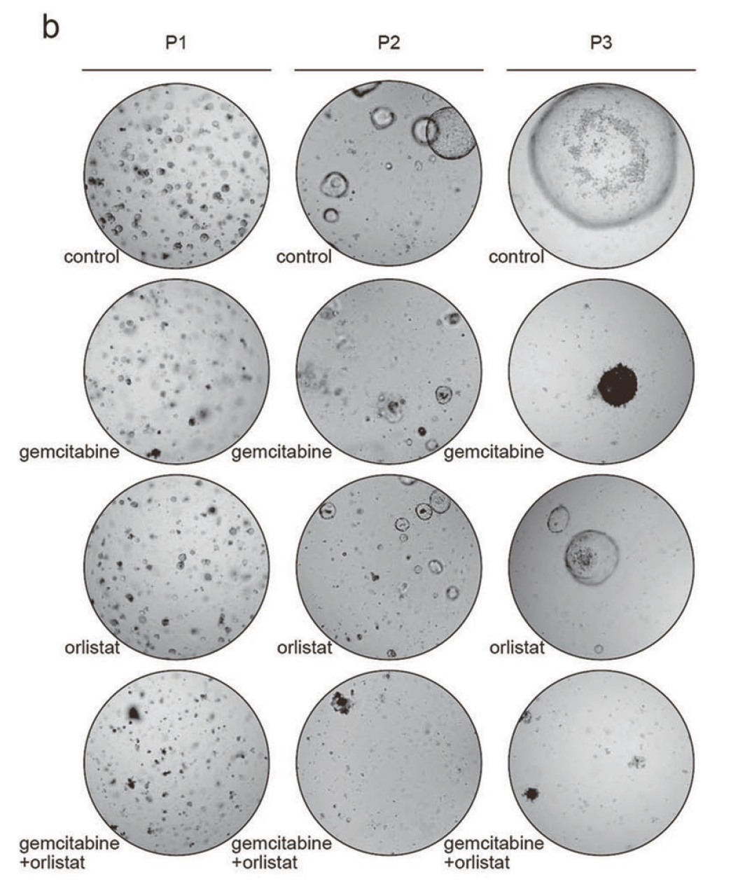 客户文章解读 | 类器官模型揭示ACOT8调控脂代谢与铁死亡介导的胰腺癌耐药新机制 - 北京科途医学科技有限公司 — 类器官技术 | 肿瘤个体 ...