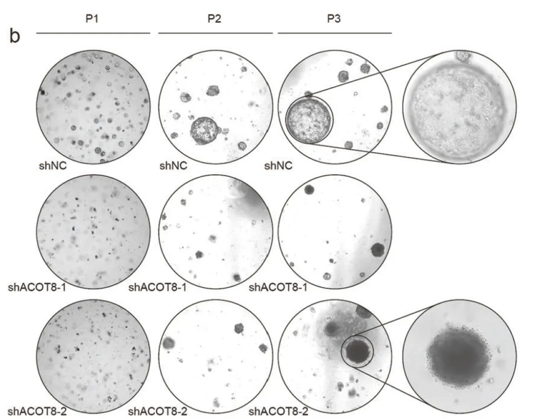 客户文章解读 | 类器官模型揭示ACOT8调控脂代谢与铁死亡介导的胰腺癌耐药新机制 - 北京科途医学科技有限公司 — 类器官技术 | 肿瘤个体 ...